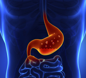 Colonoscopy Los Angeles GERD and Barrett’s Esophagus Los Angeles